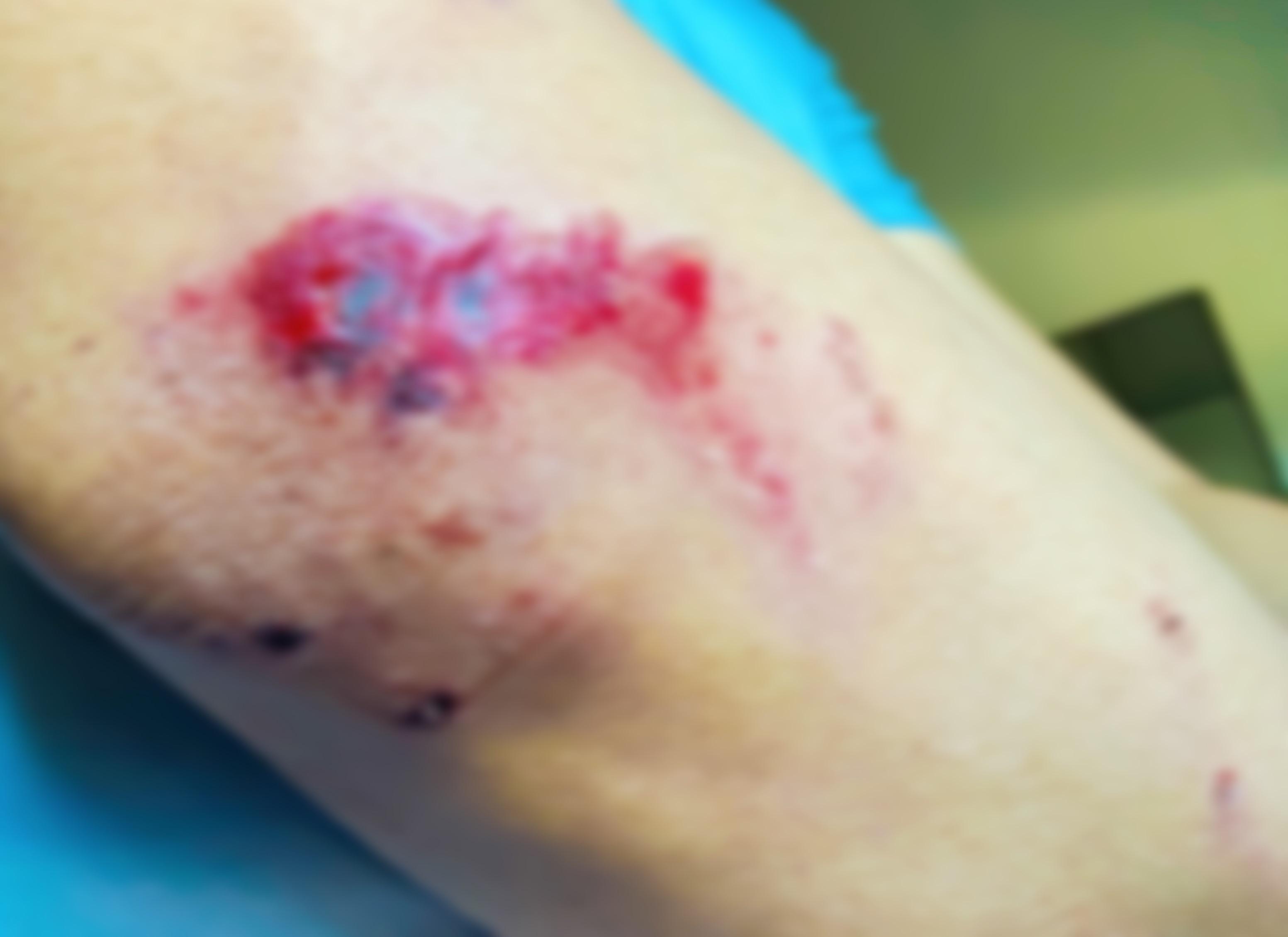 Don’t take a road bike on gravel! Know your bike’s and your skill’s limits. 😭 - Cycling Europe